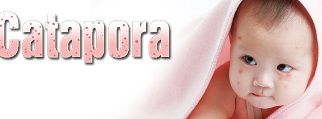 Saiba mais sobre a catapora